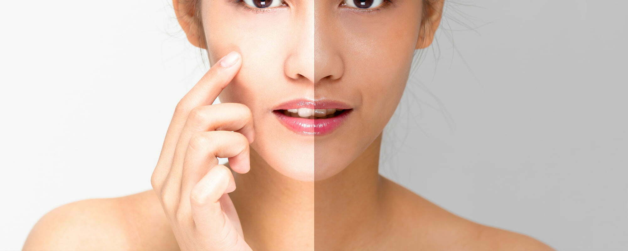 Smile Gallery Twickenham | Smile Makeover Kingston Upon Thames